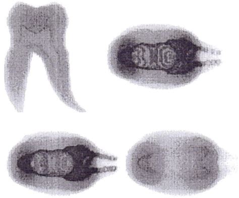 figure 1 from implementing and applying direct volume rendering with