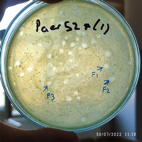 Pseudomonas Aeruginosa Bacteriophage 130052f Mikroliz