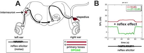 Auditory Reflex Pathway
