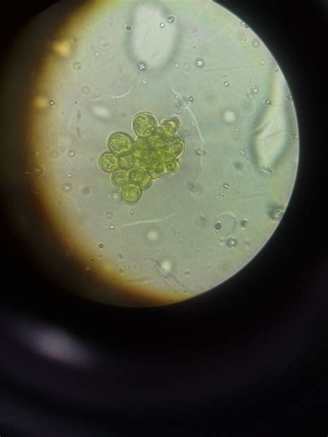 Can An Expert Please Give Me Advice On This Specific Microalgae Identification