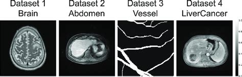 Example Of Images In Each Dataset Used In Numerical Simulations See Download Scientific