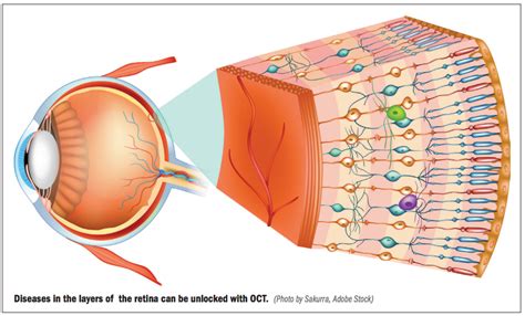 Oct Illuminating The Retina Layer By Layer