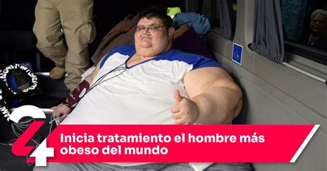 Inicia tratamiento el hombre más obeso del mundo Noticias24Siete