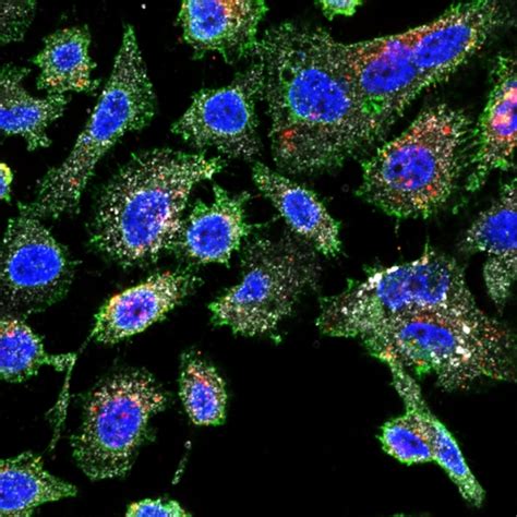 Pc3 Prostate Cancer Cells Taking Up Rparpar Agnps Red Also Showing
