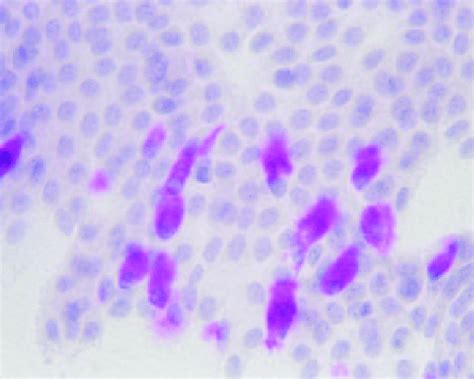 Células Caliciformes O Goblet Del Epitelio Conjuntival Sujeto De
