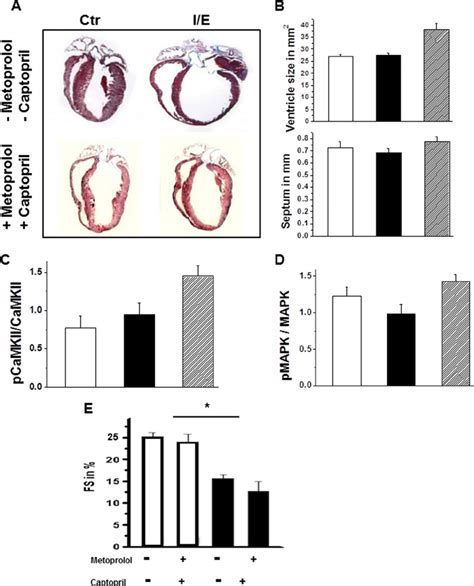 Effects Of Metoprolol And Captopril On Ctr And I E Mice At Day 10 A
