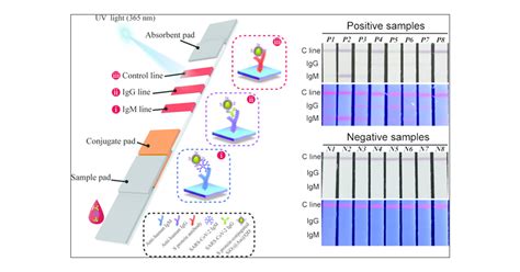 Sensitive And Simultaneous Detection Of Sars Cov 2 Specific Igmigg Using Lateral Flow