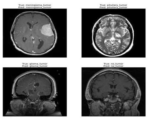 Diagnostics Free Full Text Exploring The Power Of Deep Learning Fine Tuned Vision
