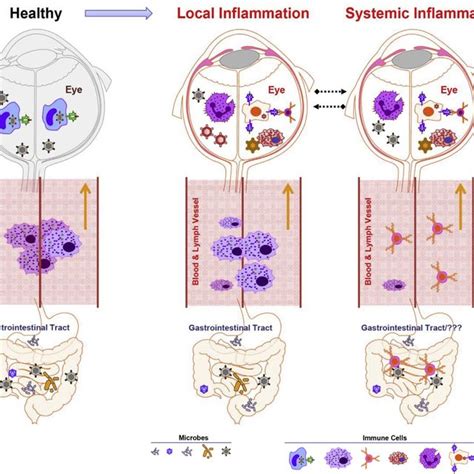 The Strategies Controlling Ocular Inflammation Traditional Therapies