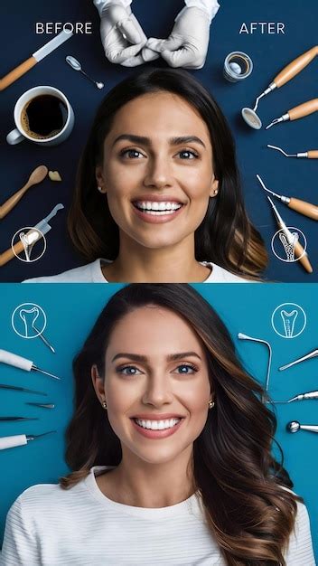 Woman Teeth Before And After Whitening Image Symbolizes Stomatology
