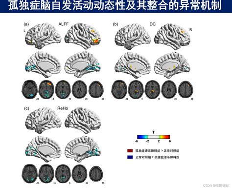 静息态功能磁共振成像rs Fmri原理与数据分析——2nilearn分析rs Fmri Csdn博客