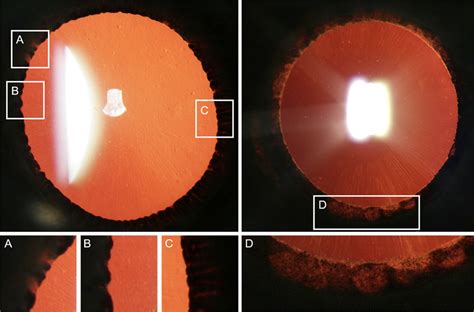 Photos Of Two Different Patients Illustrating The Four Different Types Download Scientific