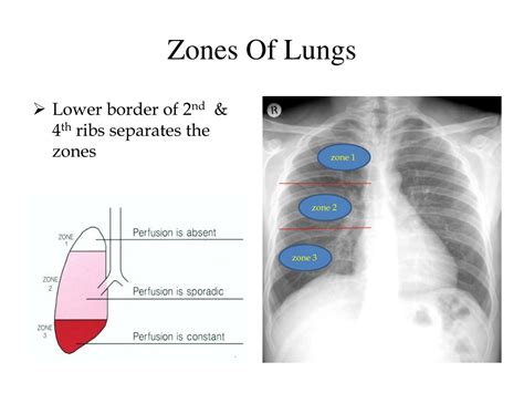 Ppt Normal Chest X Ray Powerpoint Presentation Free Download Id