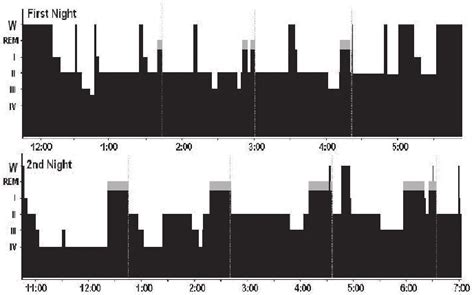 Hypnogram From A Single Subject In Two Consecutive Nights Sleeping In