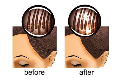 Suffering From Itchy Scalp 7 Reasons For Itchy Scalp Causes