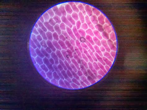 BiologÍa GeologÍaies Sierra Blanca Marbella Epidermis Vegetal