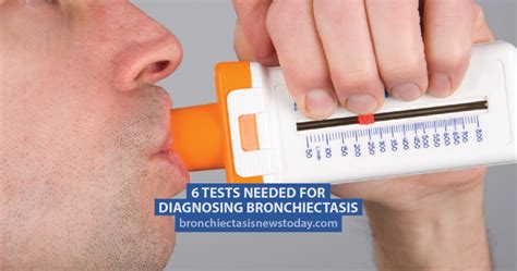 6 Tests Needed For Diagnosing Bronchiectasis Bronchiectasis News Today