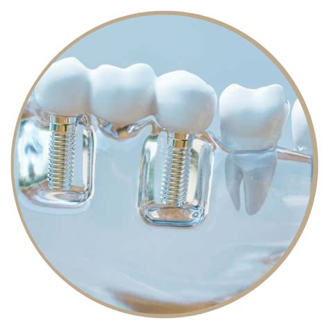 Aftercare Dental Implants Brunswick Dental Practice