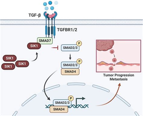 SIK suppresses colorectal cancer metastasis and chemoresistance via the TGF β signaling pathway