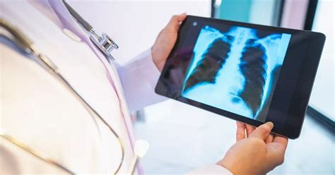 Lung Cancer Red Flag Symptoms As Expert Says See A Gp