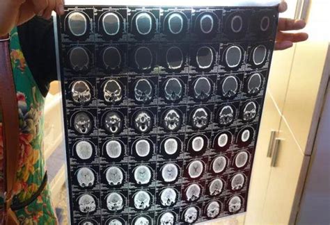 毕节一出租车司机凌晨被乘客殴打，所为何事？