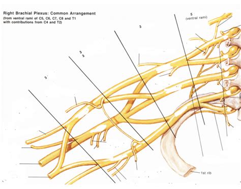 Brachial Plexus Label Quiz