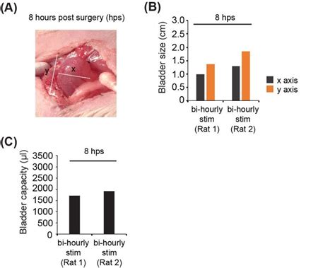 On Demand Pelvic Nerve Stimulation Reduced Over Distension Of Bladder