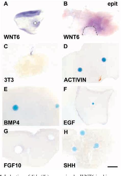 Ectodermal Dysplasia 11a Hypohidrotic Hair Tooth Type Autosomal Dominant Semantic Scholar