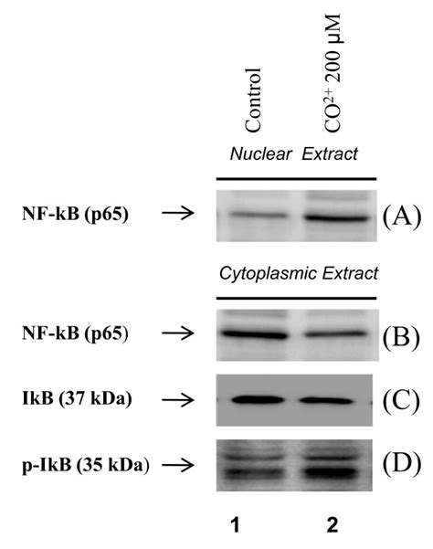 Western Analysis Showing Nf κb Translocation In Nucleus From Cytoplasm