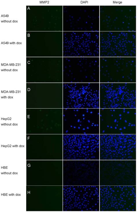 Immunofluorescence Staining For MMP 2 Green In Cytoplasm And Nucleus