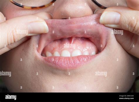 Close Up Shot Of A Persons Open Mouth Displaying Healthy Teeth And