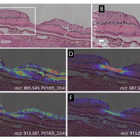 Six Maldi Ims Signals With Distinct Laminar Localizations In Human
