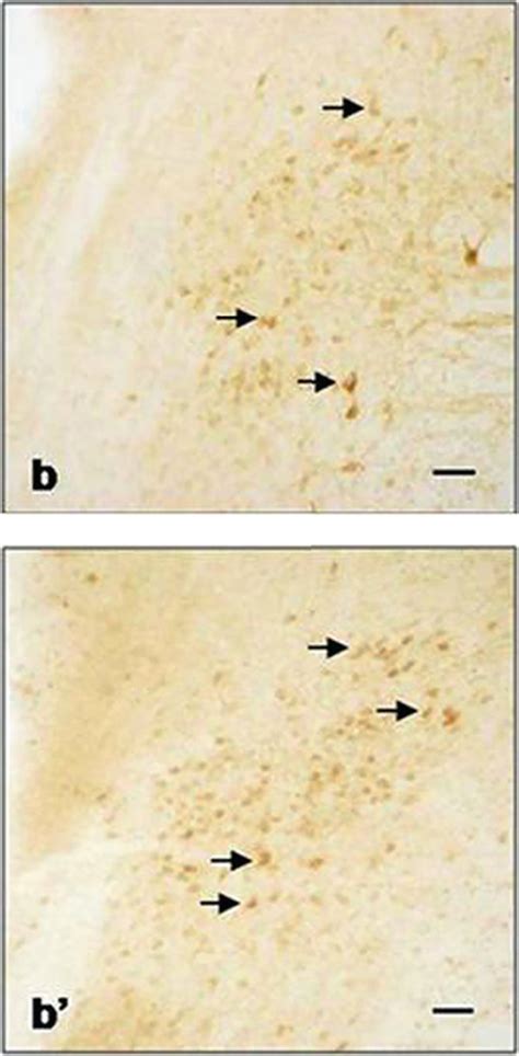 Nnos Positive Neurons In The Ipsilateral Spinal Trigeminal Nucleus A Download Scientific
