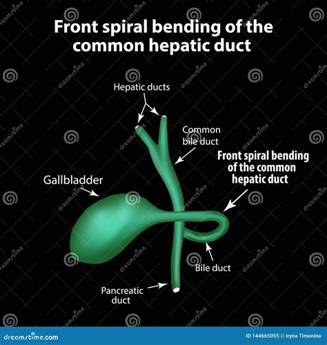 Front Spiral Bending Of The Common Hepatic Duct Pathology Of The