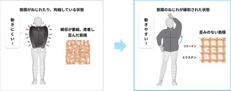 メディセルで行う筋膜リリースとは 筋膜・fasciaファッシャリリースmedicell（メディセル）のパイオニア【公式】mjカンパニー