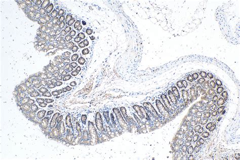 E Cadherin Antibody 20874 1 Ap Proteintech 武汉三鹰生物技术有限公司