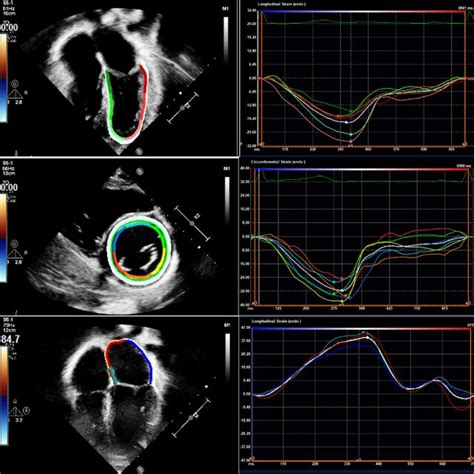 Strain Analysis Strain Curve Analyses Ath Lower Cs At 310 Week