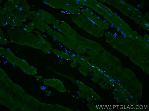 TRIM72 antibody 67403 1 Ig Proteintech 武汉三鹰生物技术有限公司