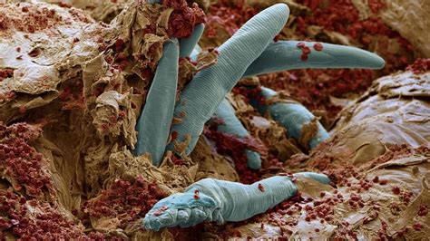 Demodex Folliculorum Mites