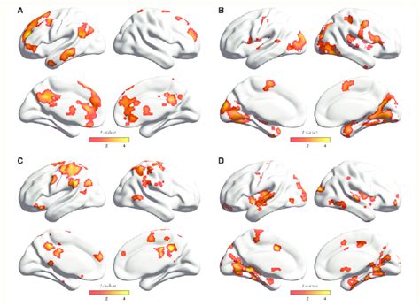 Functional Connectivity Of The Posterior Cingulate Cortex And An