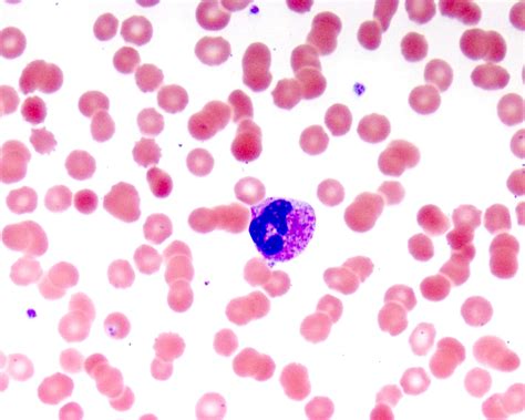 Toxic Neutrophils