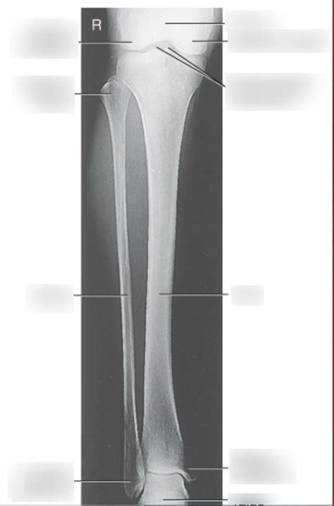 AP Lower Leg Anatomy Diagram Quizlet