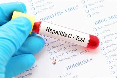HEP C Test KC Our Health Matters