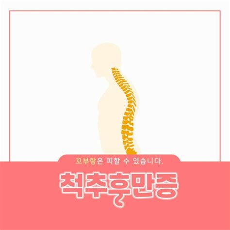 유명한척추병원 척추후만증 치료 이렇게 네이버 블로그