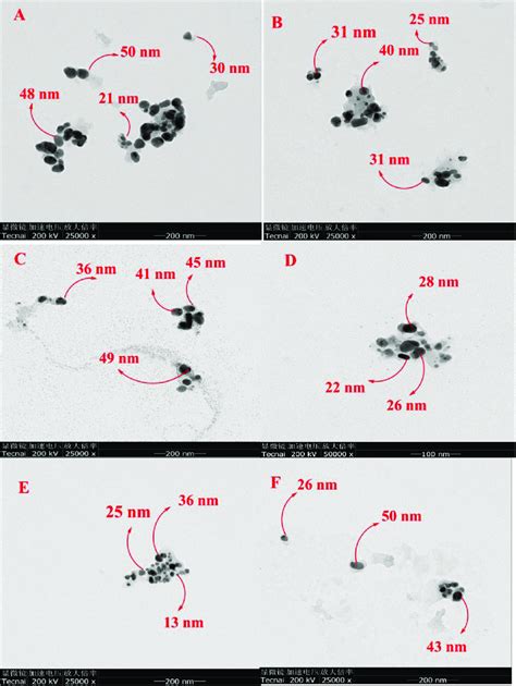 Transmission Electron Microscopy Tem Analysis Of R Agnps A B