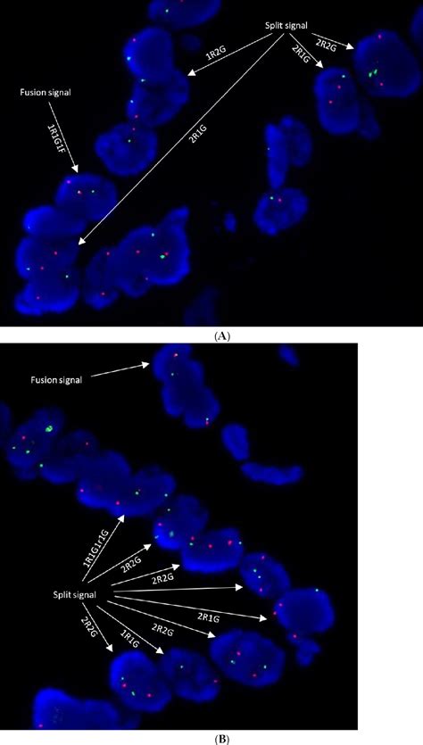 Figure 4 From A Robust Fish Assay To Detect Fgfr2 Translocations In