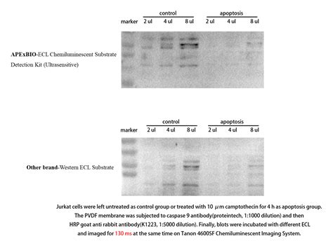 Apexbio Ecl Chemiluminescent Substrate Detection Kit Ultrasensitive