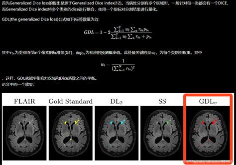 概念 医学图像分割中常用的loss Function损失函数 从loss处理图像分割中类别极度不均衡wce Loss Csdn博客