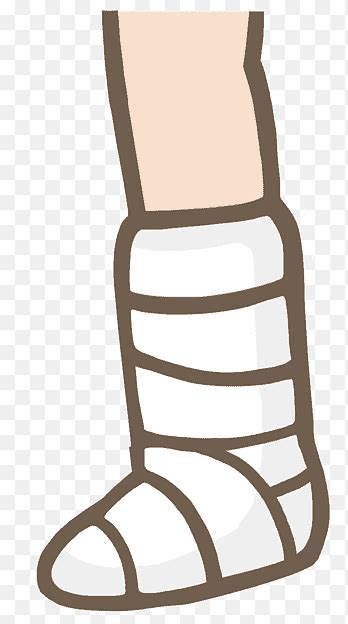 정형 외과 캐스트 인간의 다리 붕대 버팀목 골절 손 손 사진술 Png Pngegg