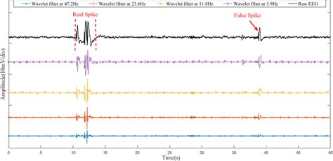 Real Time Four Scale Cwt Analysis Of Raw Eeg Signal Download
